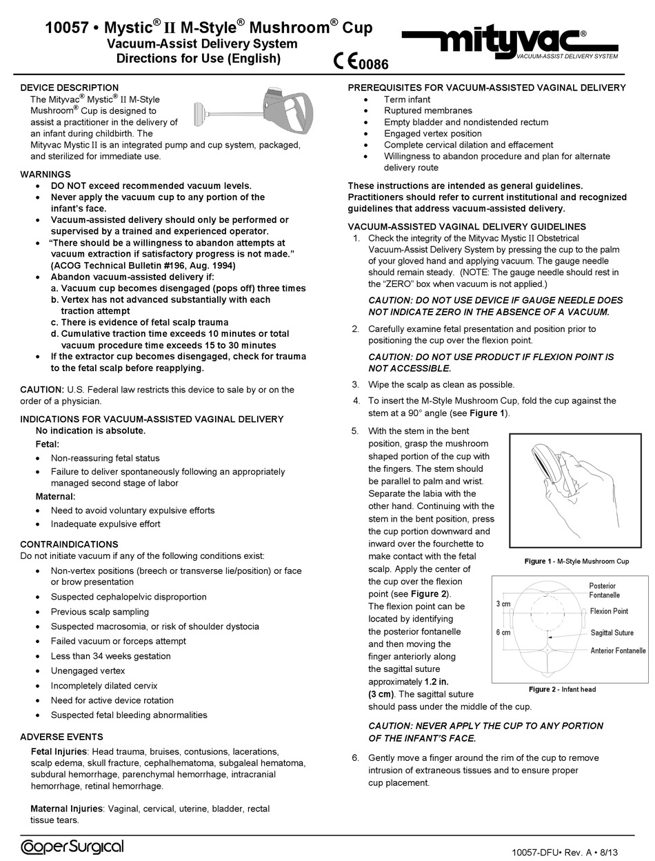 COOPERSURGICAL MITYVAC MYSTIC II M-STYLE MUSHROOM CUP DIRECTIONS FOR ...