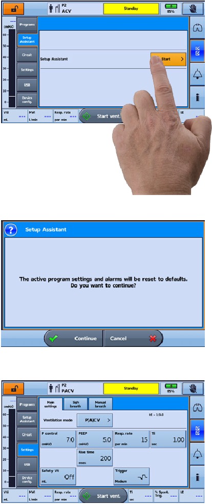 ResMed Astral Series Quick Start Guide | ManualsLib