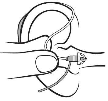Oticon Engage miniRITE - Hearing Aid Instructions For Use | ManualsLib
