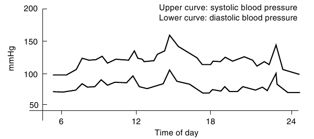 Omron M2 Basic - Digital Automatic Blood Pressure Monitor Manual ...