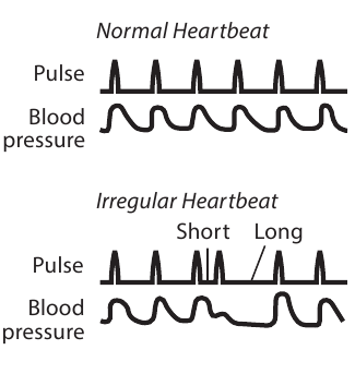 Relion 7400REL - Automatic Blood Pressure Monitor Manual | ManualsLib