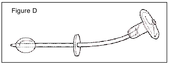 Kimberly-Clark MIC-KEY - Transgastric-Jejunal Feeding Tube Manual ...