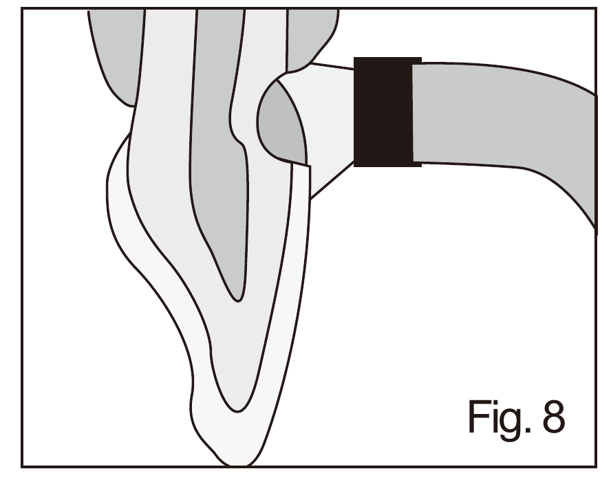 GC CORPORATION Fuji II LC CAPSULE - Radiopaque Light Cured Glass ...