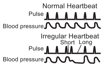 Omron M3 Comfort, HEM-7134-E - Automatic Blood Pressure Monitor Manual ...
