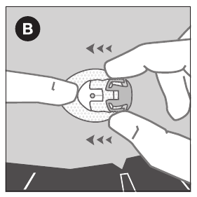 Tandem AutoSoft 90 - Infusion Set Manual | ManualsLib