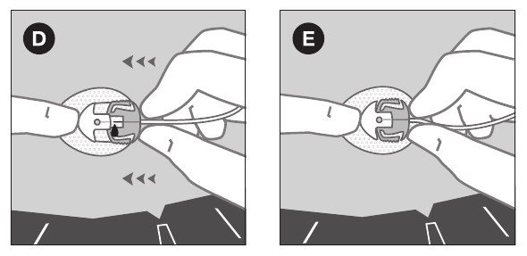 Tandem AutoSoft 90 - Infusion Set Manual | ManualsLib