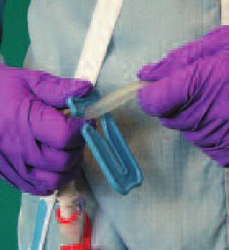 Atrium Express Mini 500 - Dry Seal Chest Drain Patient Manual and Video ...