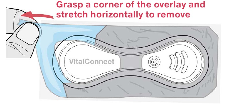 VitalConnect VitalPatch, VistaPhone MKT-198 Rev.C (June 2023) Quick ...