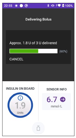 OmniPod 5 - Insulin Delivery System Manual | ManualsLib