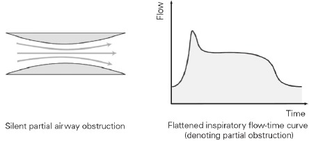 ResMed AirMini Manual | ManualsLib
