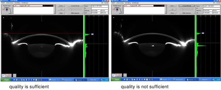 OCULUS Pentacam, PentacamHR Manual | ManualsLib