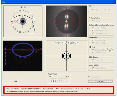 OCULUS Pentacam, PentacamHR Manual | ManualsLib
