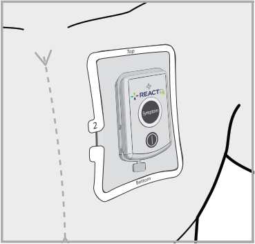 Medicomp reactDX TelePatch Holter monitor Patient Guide | ManualsLib