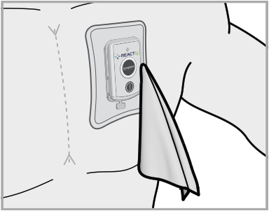 Medicomp reactDX TelePatch Holter monitor Patient Guide | ManualsLib