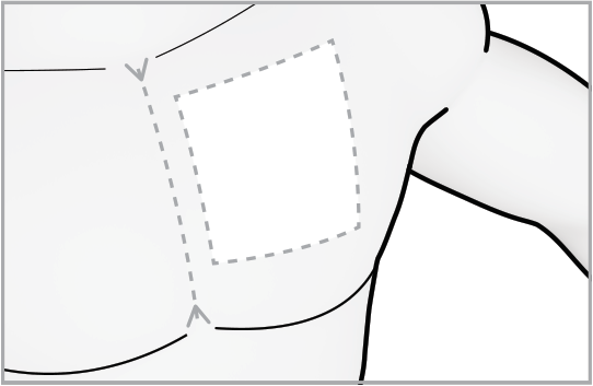 Medicomp reactDX TelePatch Holter monitor Patient Guide | ManualsLib
