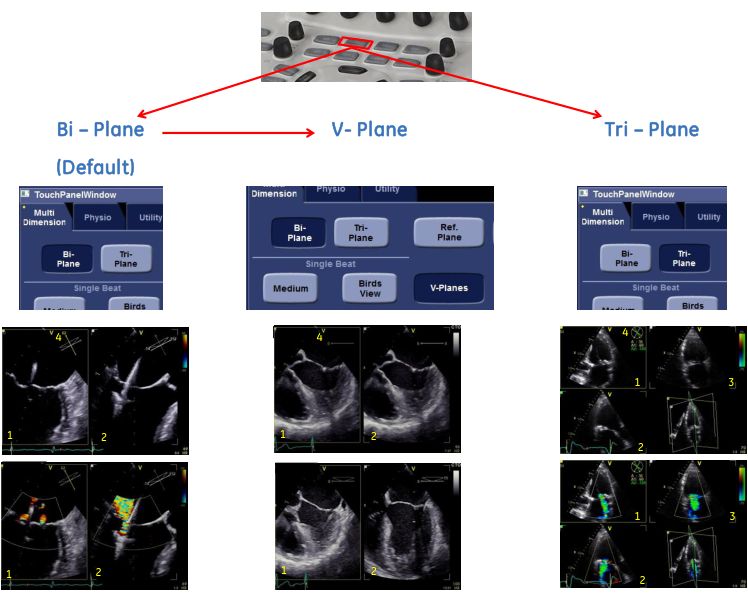 Advanced Image Quality Features for GE Vivid E9 Series | ManualsLib