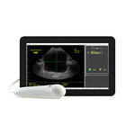 INTERSON VIEWBLADDER 10 USER MANUAL Pdf Download | ManualsLib