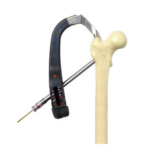 ZIMMER BIOMET ZIMMER NATURAL NAIL MANUAL Pdf Download | ManualsLib