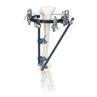 SYNTHES HYBRID FIXATOR PROXIMAL TIBIA FRAME TECHNIQUE MANUAL Pdf ...