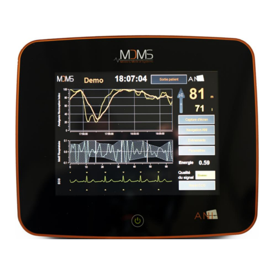 MDMS ANI MONITOR V2 USER MANUAL Pdf Download | ManualsLib
