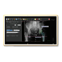 BRAINLAB BUZZ NAVIGATION SYSTEM AND TECHNICAL USER MANUAL Pdf Download ...