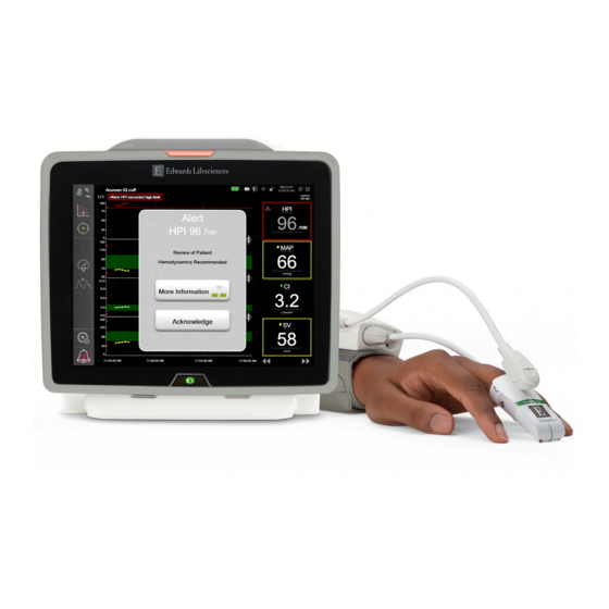 EDWARDS ACUMEN IQ CUFF SETUP MANUAL Pdf Download | ManualsLib