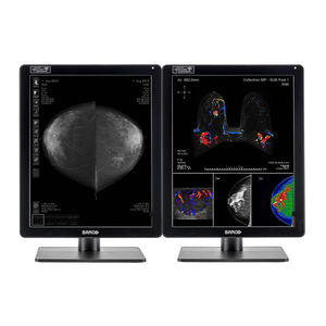 BARCO NIO COLOR 5MP MDNC-6121 USER MANUAL Pdf Download | ManualsLib